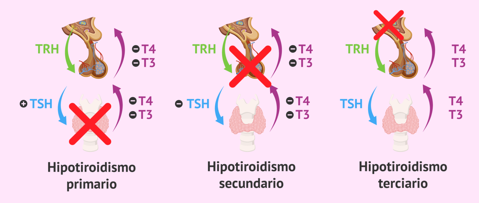 Prueba rápida de TSH (hormona estimulante de la tiroides)