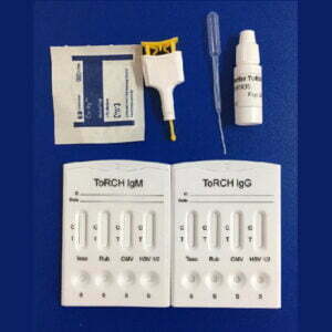 Prueba rápida de TORCH IgG e IgM - Amunet Laboratorio Portable