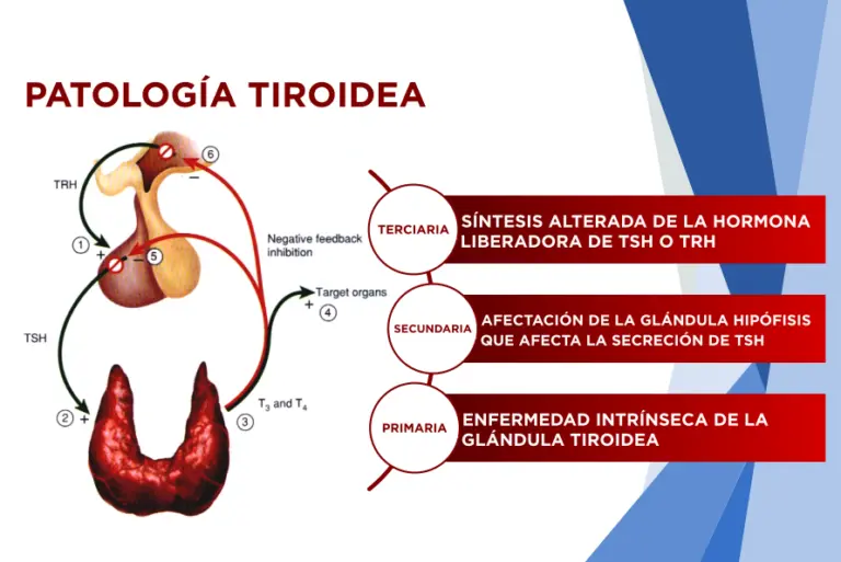 Prueba rápida de TSH (Hipertiroidismo e Hipotiroidismo) – Amunet ...